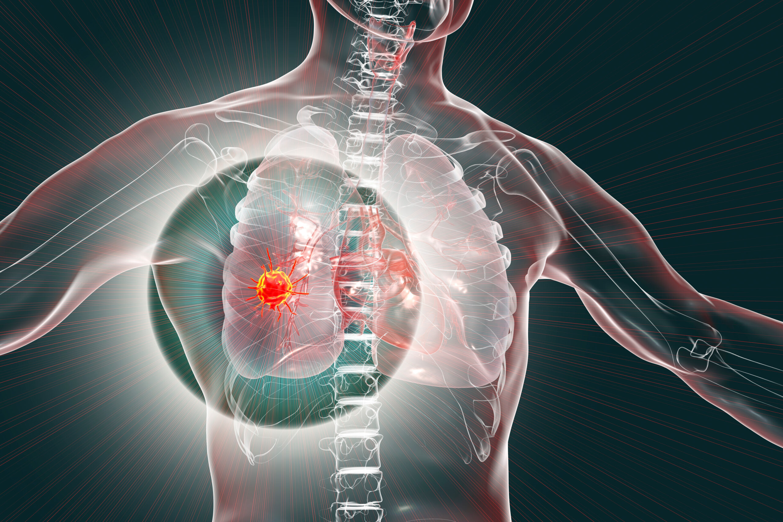 Circulating Tumor Dna Reflects Tumor Metabolism Ratherthan Tumor Burden