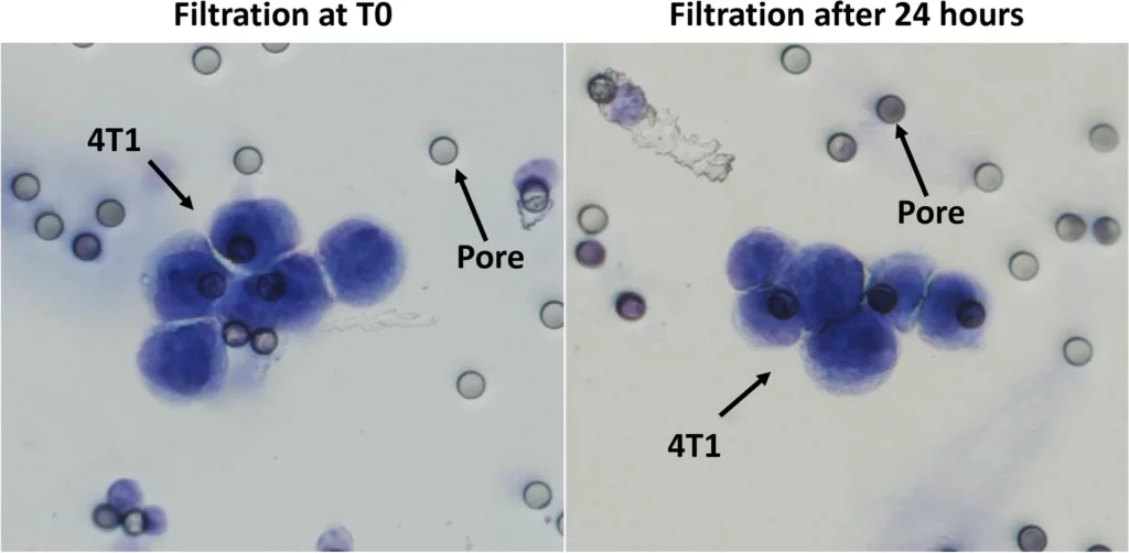 ScreenCell | Liquid Biopsy and CTC Isolation Company